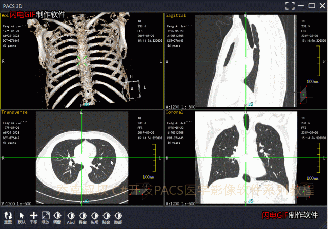 C#开发PACS医学影像三维重建(一):使用VTK重建3D影像 | 乔克灬叔叔